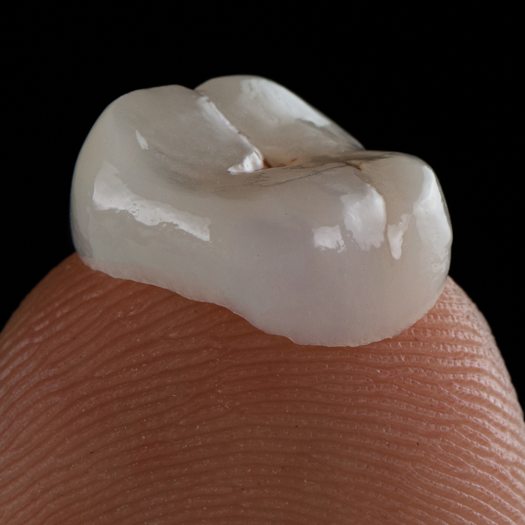 1 Best Dental Caps in Katy Texas - Mason Dental